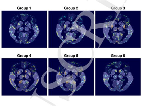 Significant Grey Matter Differences Vbm In The Study Groups P