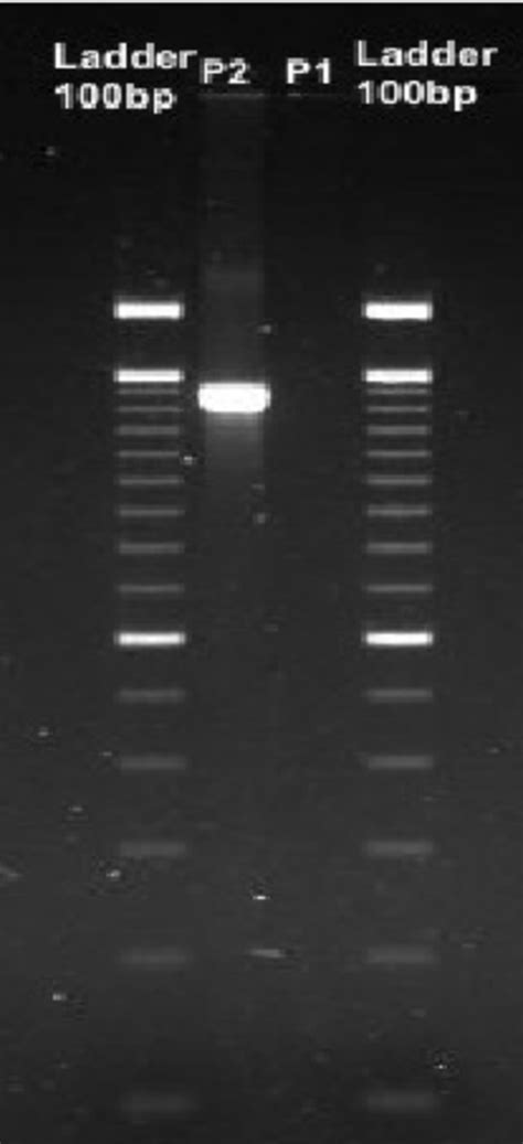 G16 1400 RAPD Fragment Converted Into SCAR Marker A DNA Size Marker Is