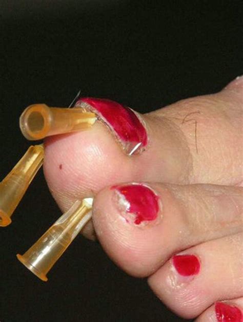 Needles Under Nails Free BDSM Needleplay Pics