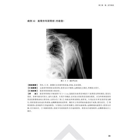 正版现货 2018年新版 X线读片指南第4版四版邢伟邱建国邹立秋精装实用临床x线影像诊断报告丛书籍江苏凤凰科学技术出版社虎窝淘