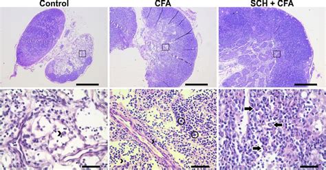 The Absence Of Mott Cells In Da Rats Treated With Adjuvant Alone Lymph