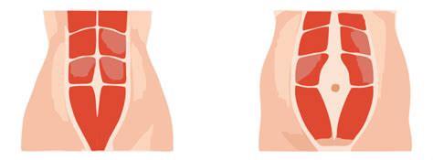 产后还是“大腹婆“？你可能腹直肌分离了 知乎