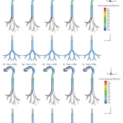 Transient Airflow Patterns In The Idealized Human Upper Airway Model Download Scientific