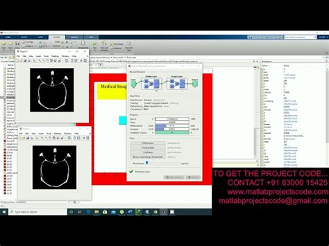 Image Fusion With Deep Learning Reason Town