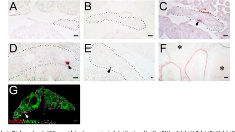 Figure 1 From Expression Of 3β Hydroxysteroid Dehydrogenase Hsd3b