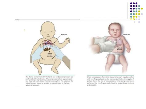 Neonatal Resuscitation Paediatrics Neonatologypptx