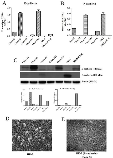 The Effect Of Forced Overexpression Of E Cadherin On The Expression Of