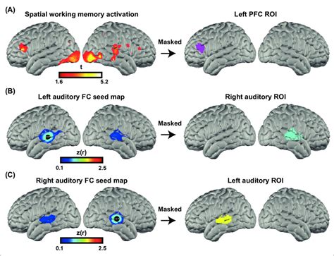 Defining Functional Regions Of Interest Rois A Spatial Working
