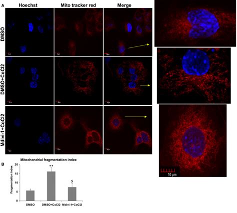 Mitochondrial Division Inhibitor 1 Mdivi 1 Prevents Cocl2 Induced