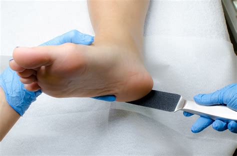 미용실에서 전문 의료 페디큐어 절차를 수행하는 파란색 장갑을 낀 페디큐어 발 뒤꿈치를 닦기위한 특수 강판으로 발 치료 서비스에
