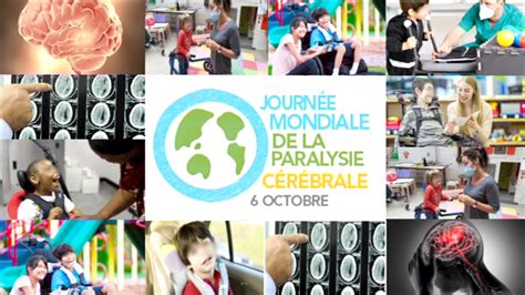 VidÉo Journée Mondiale De La Paralysie Cérébrale Le Nombre D