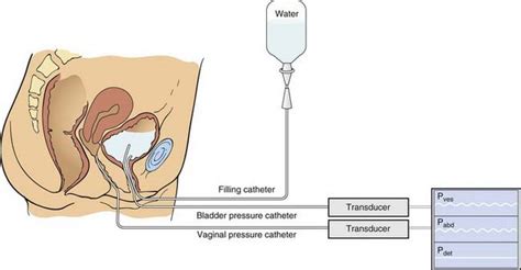 Urodynamic Testing Procedure