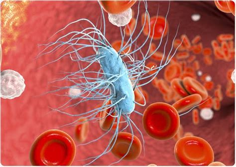 Sepsis Symptoms Causes And Risk Factors