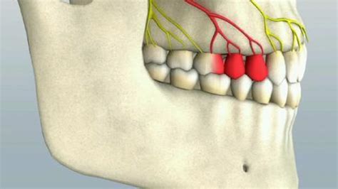 Anterior Superior Alveolar Nerve Block