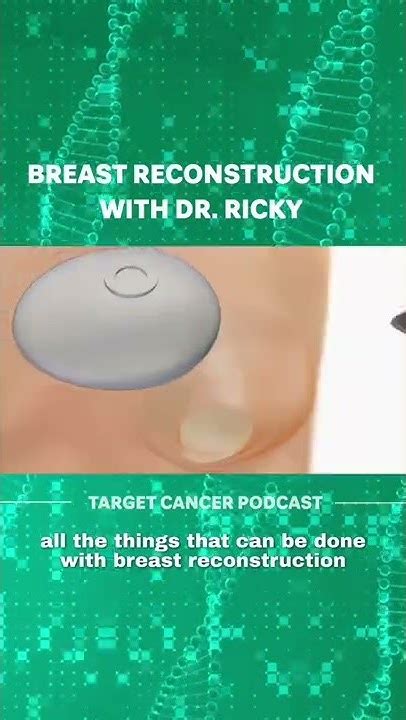 New Options For Women Needing Mastectomies 🥳 Savetheboobies
