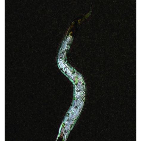 Rhabditiform Larva Of Strongyloides Stercoralis Recovered From
