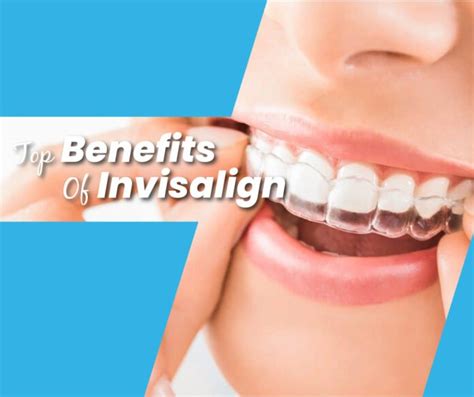 Top Benefits Of Invisalign For Misaligned Teeth Food N Health