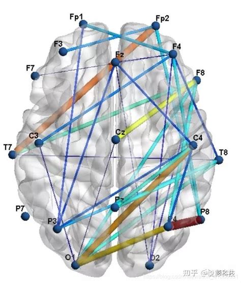 如何利用brainnet Viewer工具包实现eeg功能连接的可视化？ 知乎