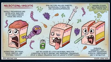 Necrotizing Soft Tissue Infectionpptx