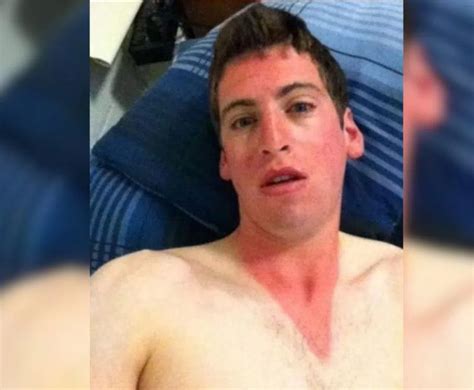 These Are The Most Ridiculous Sunburns You Will Ever See Investructor