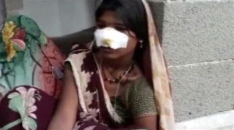 Mp Womans Nose Chopped Off For Refusing To Work As Bonded Labour