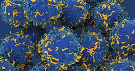 Scientists Discover Cause Of Lupus And Possible Way To Reverse It The