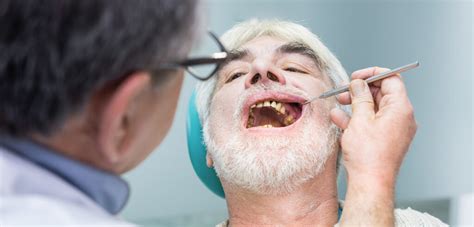 C9 Gum Disease Dg