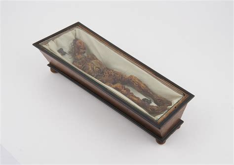 Wax Model Of A Decomposing Body In A Walnut Coffin Italy 1774 1800