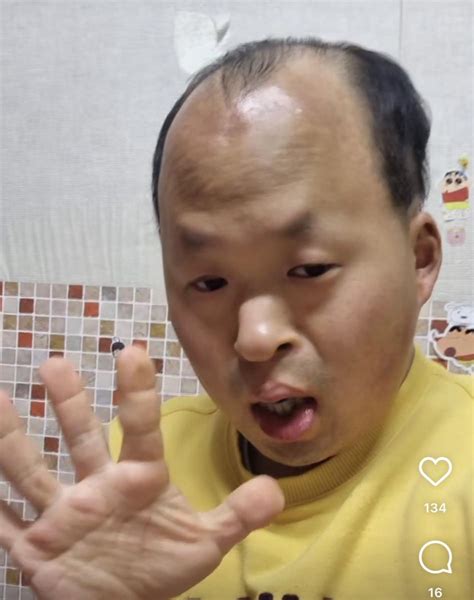 청년의꿈 26살 브베