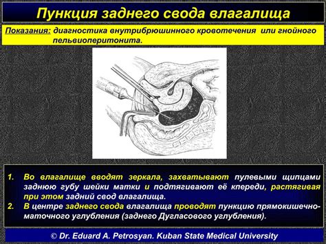 Операции на мочевом пузыре - online presentation