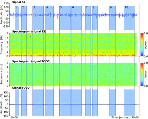Manual Annotations Of Non Pregnant Dummy Intervals In The Record