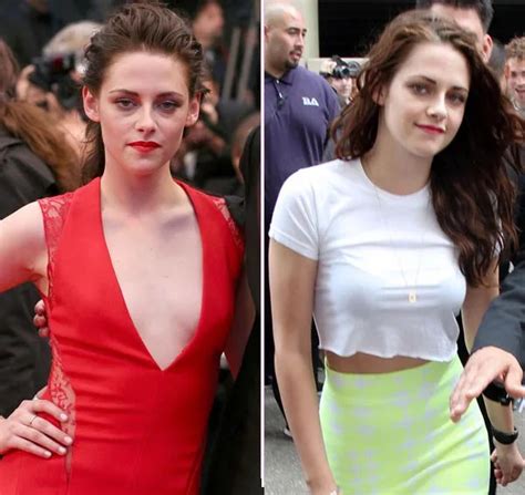 Kristen Stewart Got Breast Implants Plastic Surgeons Believe
