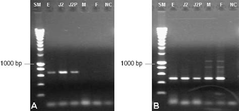 expression pattern of the rbp 1 transcripts in different developmental