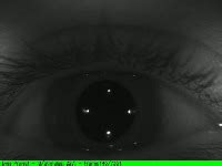 Eye Detection Team Roboflow Universe