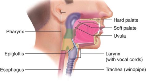 Polypoid Corditis Medical Centric