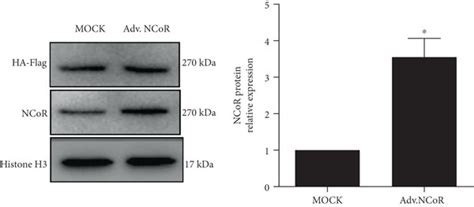 Ncor Overexpression Inhibited The Ox Ldl Induced Inflammatory Response