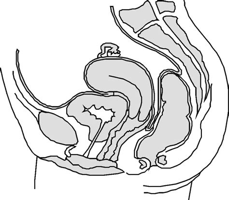 male and female sexual organs by openstax jobilize