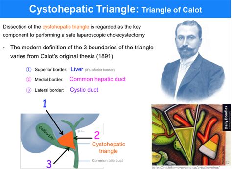 Cystohepatic Triangle