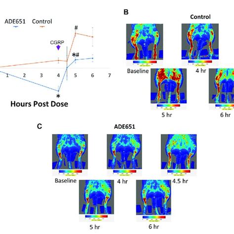 Reduction Of Cgrp Induced Dermal Vasodilation In The Hindlimbs Of Adult