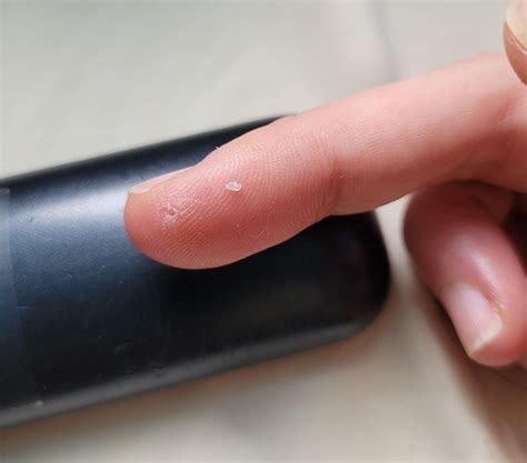 How To Get Glass Out Of Hand Storables