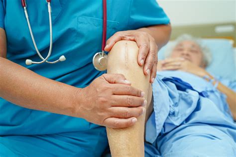 병원에서 흉터 무릎 교체 수술을받은 아시아 노인 여성 환자를 확인하는 의사 무릎에 대한 스톡 사진 및 기타 이미지 무릎
