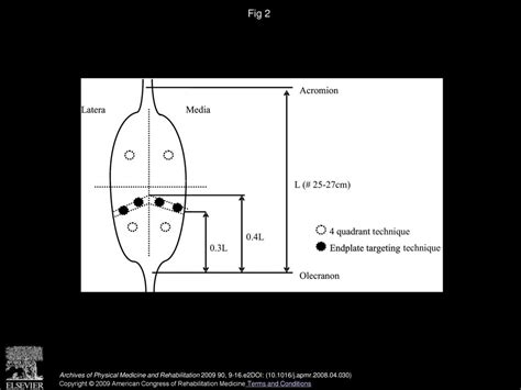 Jean Michel Gracies Md Mara Lugassy Md Donald J Ppt Download