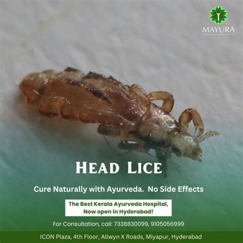 Effective Head Lice Treatment At Mayura Ayurveda And Siddha Hospital