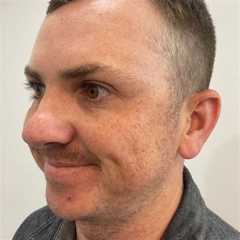 Anti Ageing Beauty Tailored To You By Skinsentials