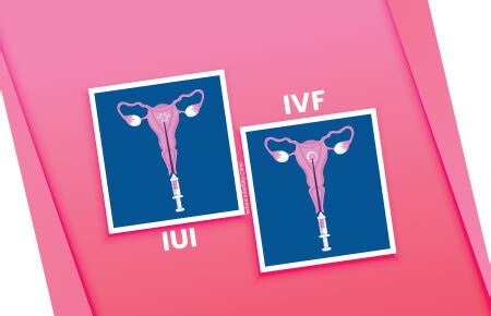 Whats The Difference Between IUI And IVF Which Is Better