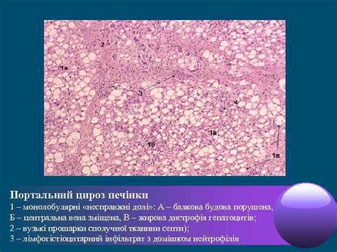 ХВОРОБИ ПЕЧІНКИ ЖОВЧОВИВІДНОЇ СИСТЕМИ ТА ПІДШЛУНКОВОЇ ЗАЛОЗИ