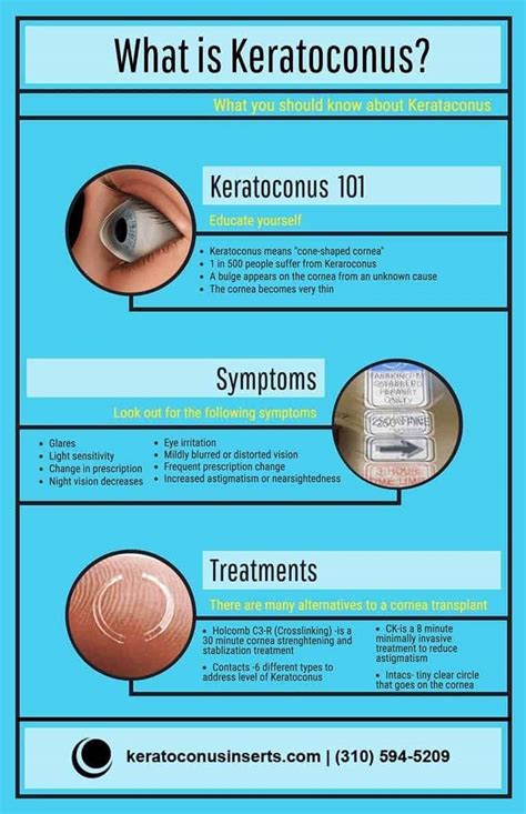 Keratoconus Treatment