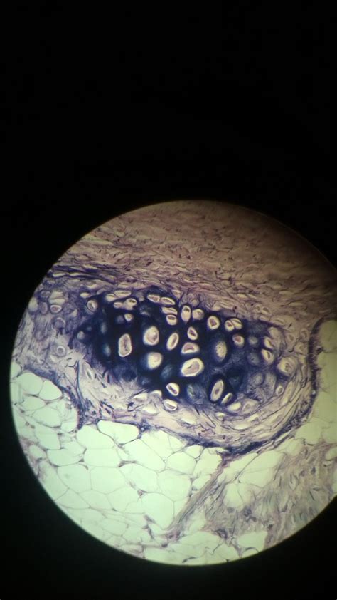 Elastic Cartilage Connective Tissue Histology Slides Science Rules