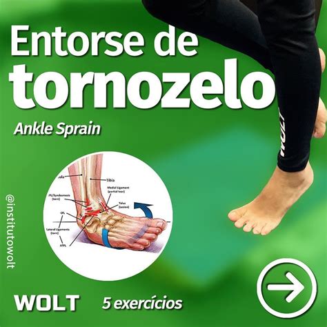 Instituto Wolt on Instagram Entorse de tornozelo O pé e o