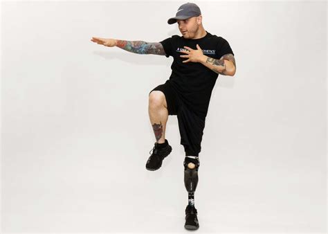 Rotationplasty Is A Type Of Amputation Is Typically Applied In Cases Of